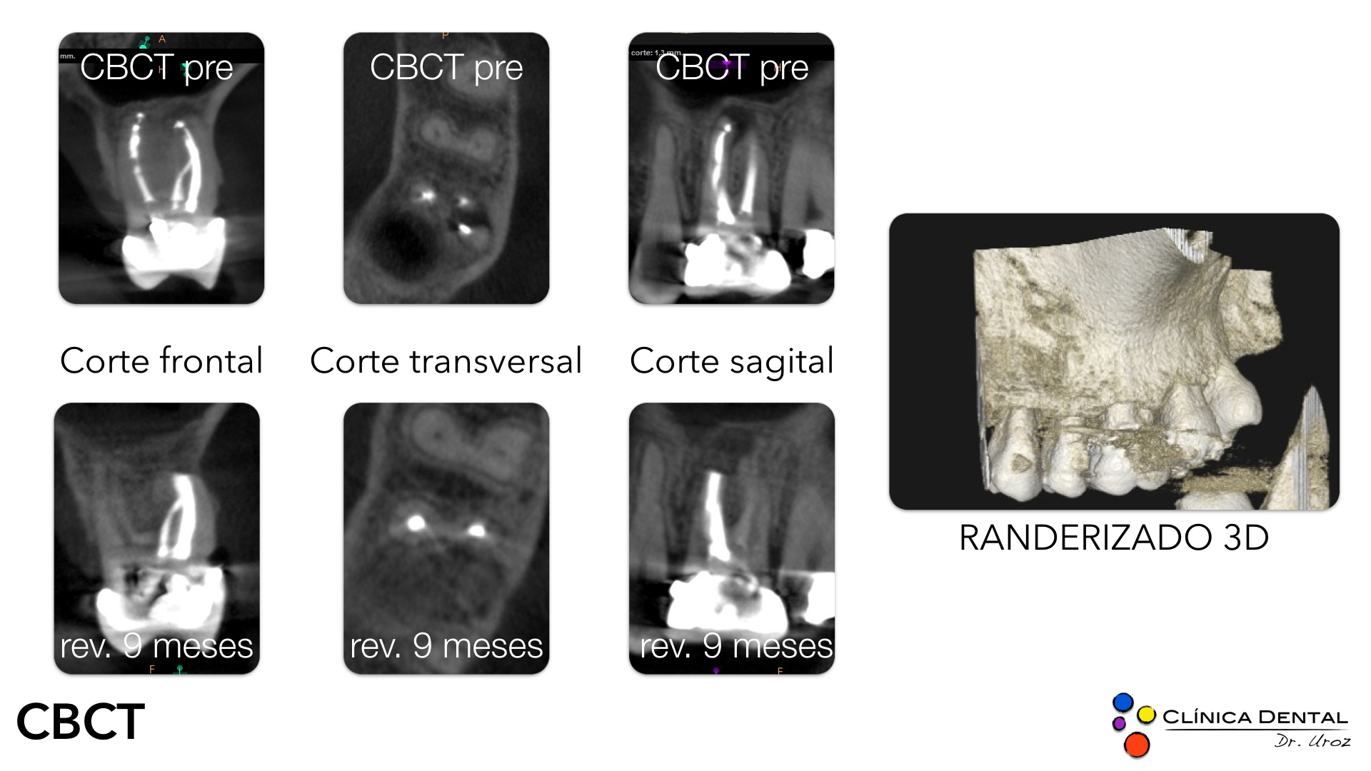 Bendita cirugía! – Daviduroz